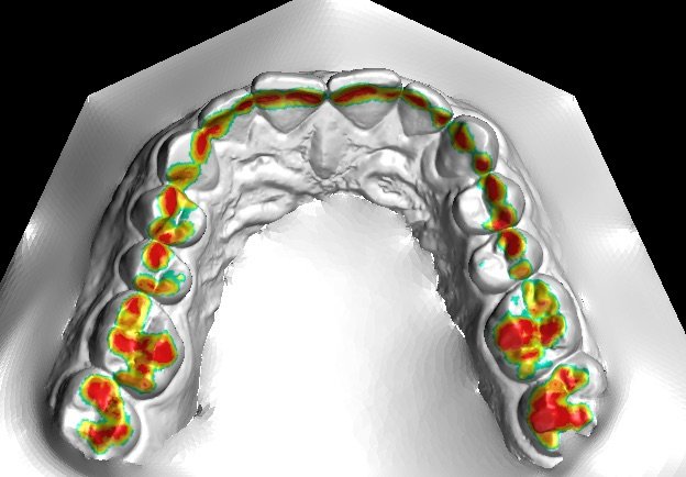 Clínica radiológica en Madrid | Imagen Diagnóstica Dental Dr. Mayor